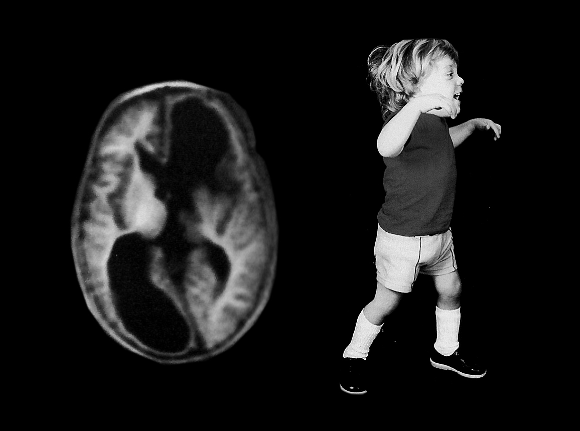 #3 Your Baby Has a Brain Problem – KAREN PAPE, MD